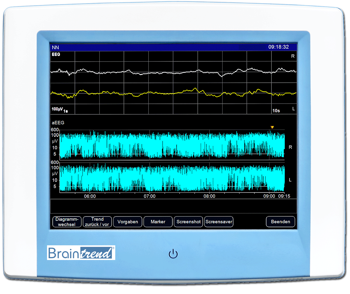 Braintrend aEEG Monitor für die Neonatologie - Der aEEG-Monitor ...
